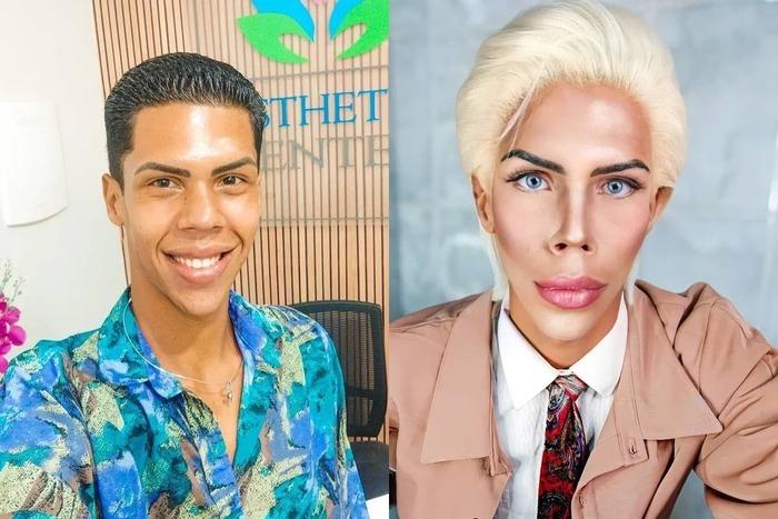 Aos 20 anos, “Ken Humano” desiste de customização para virar frentista ...